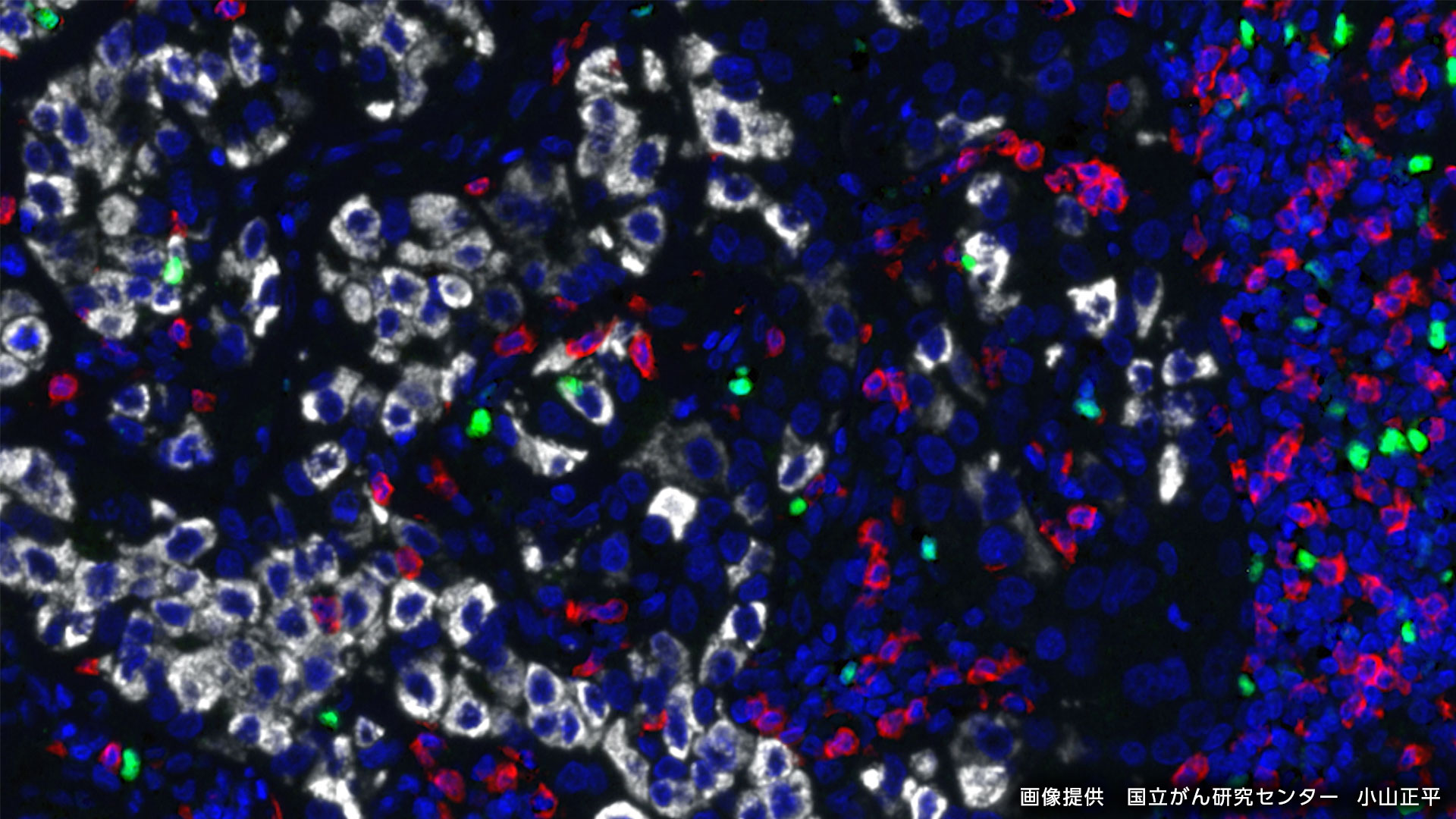 ノーベル賞受賞！坂口志文さん・北川 進さんを大特集！「サイエンスZERO」「クローズアップ現代」 - NHK